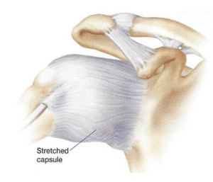 Unstable Shoulder or Capsule | Dr Skedros Orthopaedics
